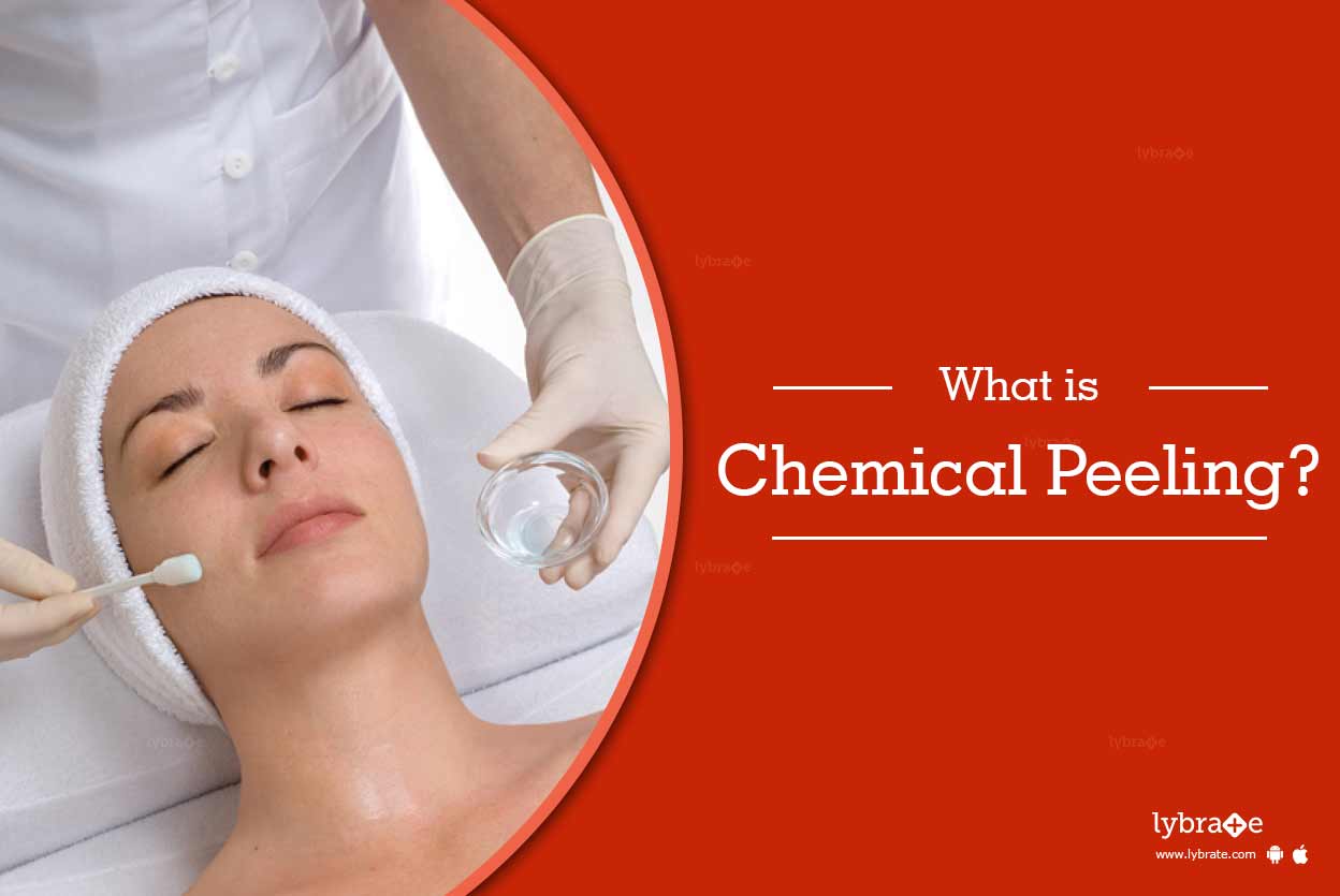 What Is Chemical Peeling? - By Dr. Sandesh Gupta | Lybrate