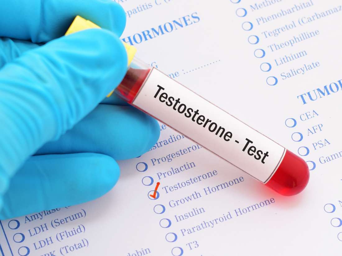 Testosterone Blood Test Results Explained! - By Dr. Azad | Lybrate