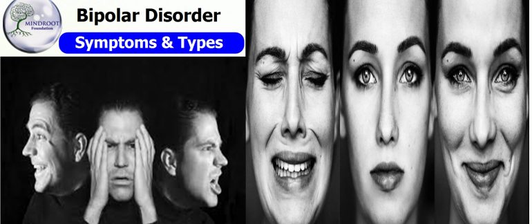 Bipolar Disorder, Symptoms,Types & Treatment - By Dr. D. S. Poonia ...