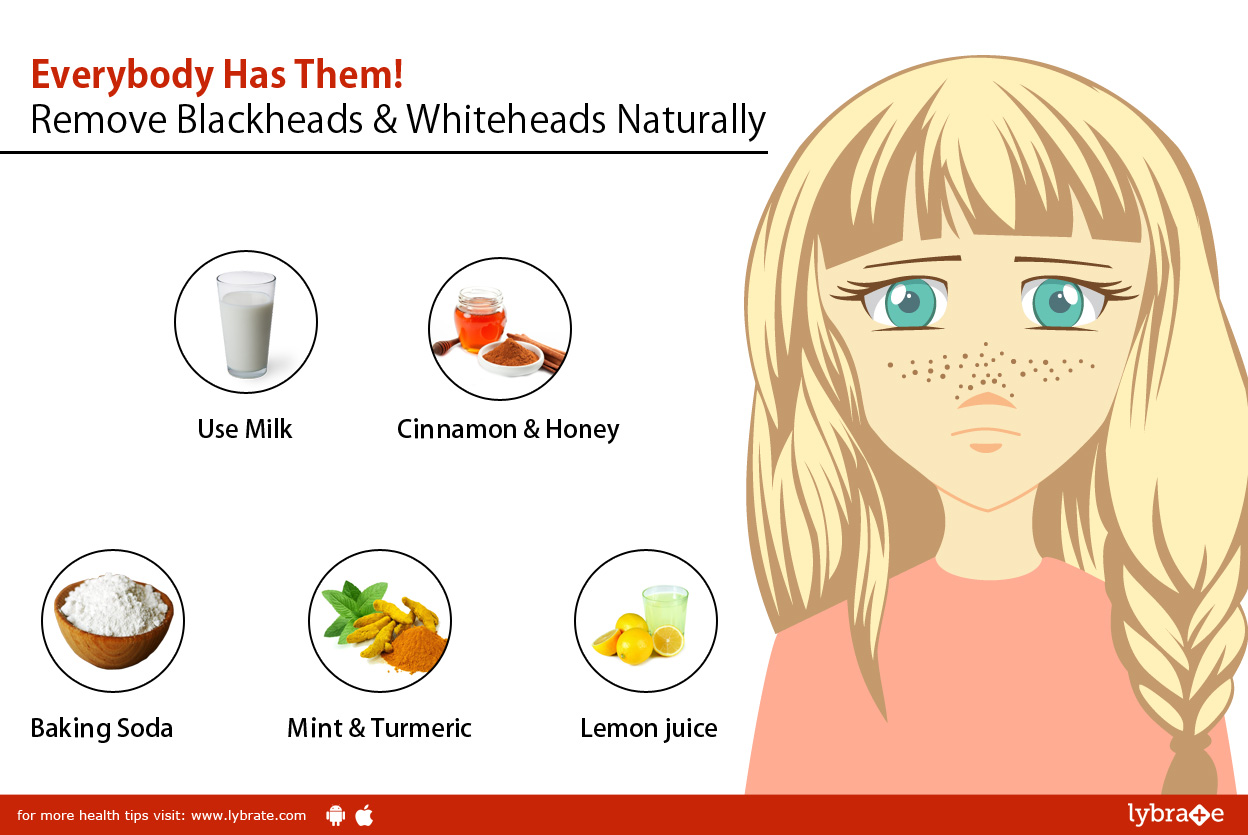 Everybody Has Them! Remove Blackheads & Whiteheads Naturally. - By Dr ...