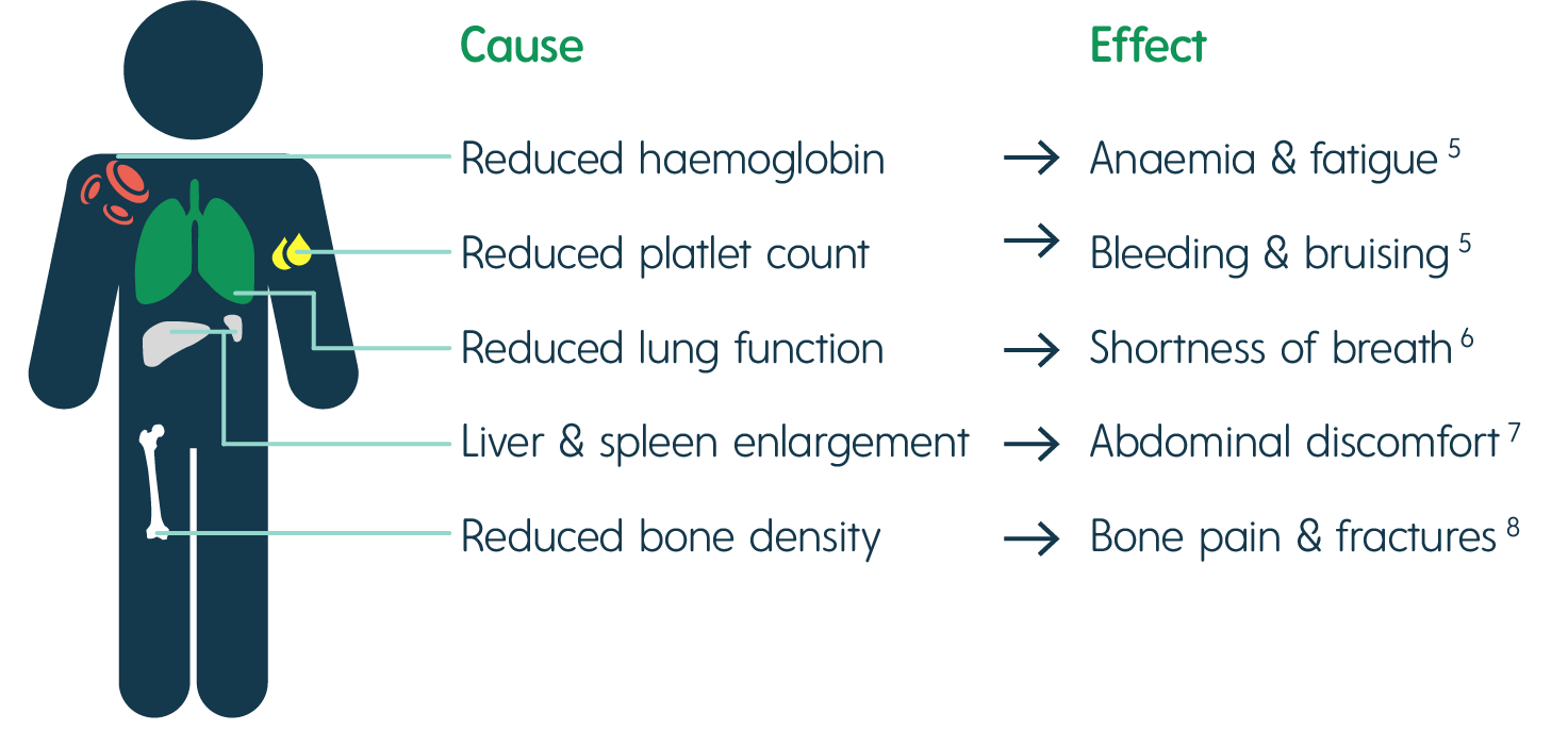 What is Gaucher s disease? - By Dr. Radhika Amulraj | Lybrate