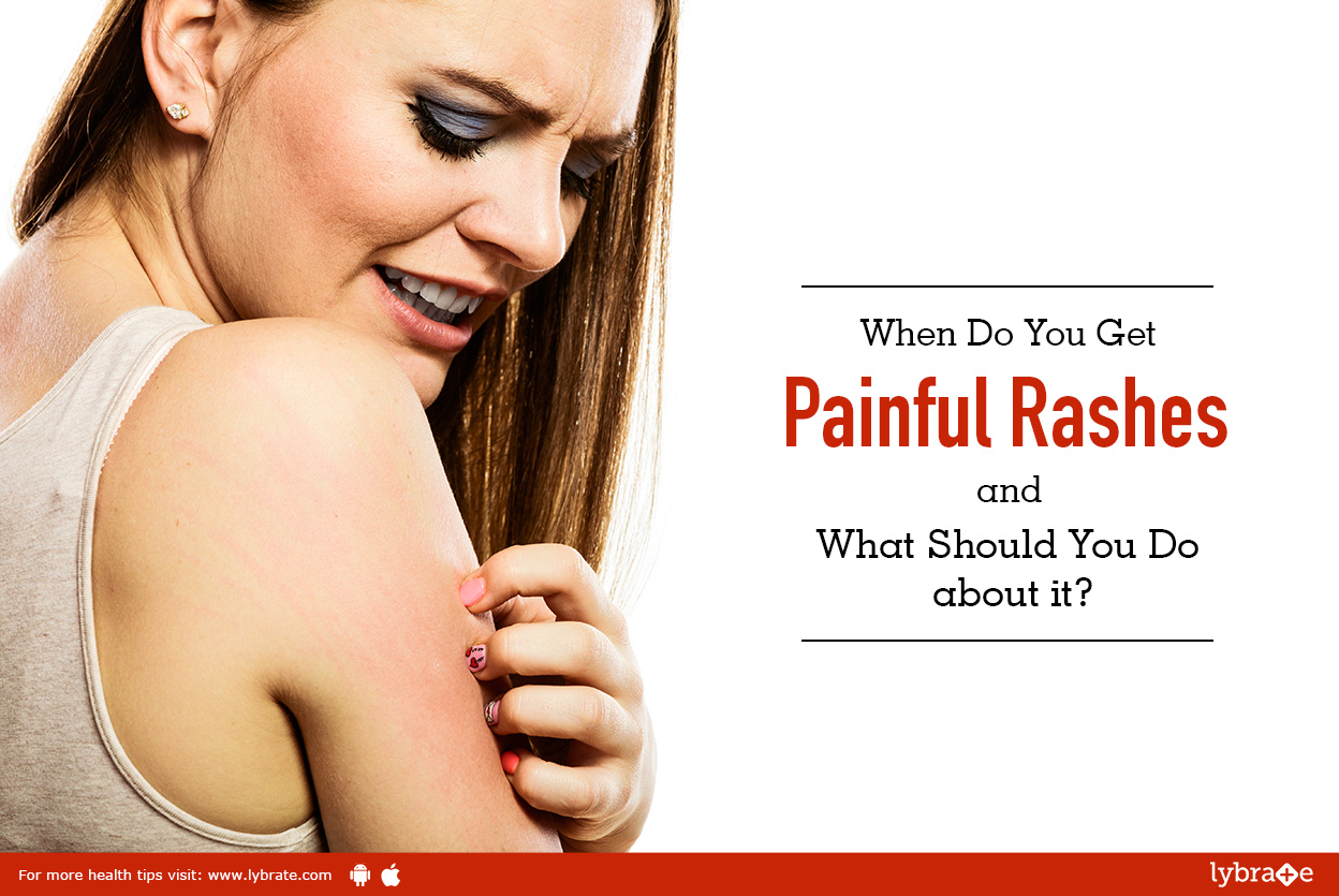 When Do You Get Painful Rashes and What Should You Do about it? - By Dr ...