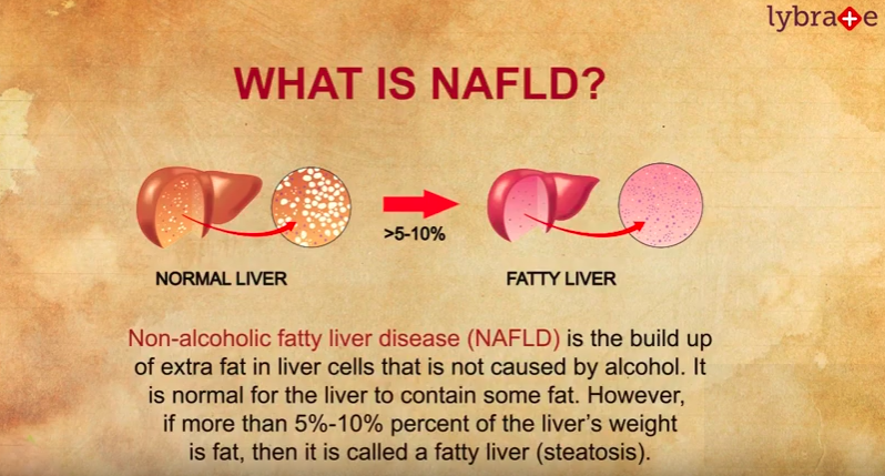 What Is NAFLD? - By Dr. Paresh J Thakkar | Lybrate