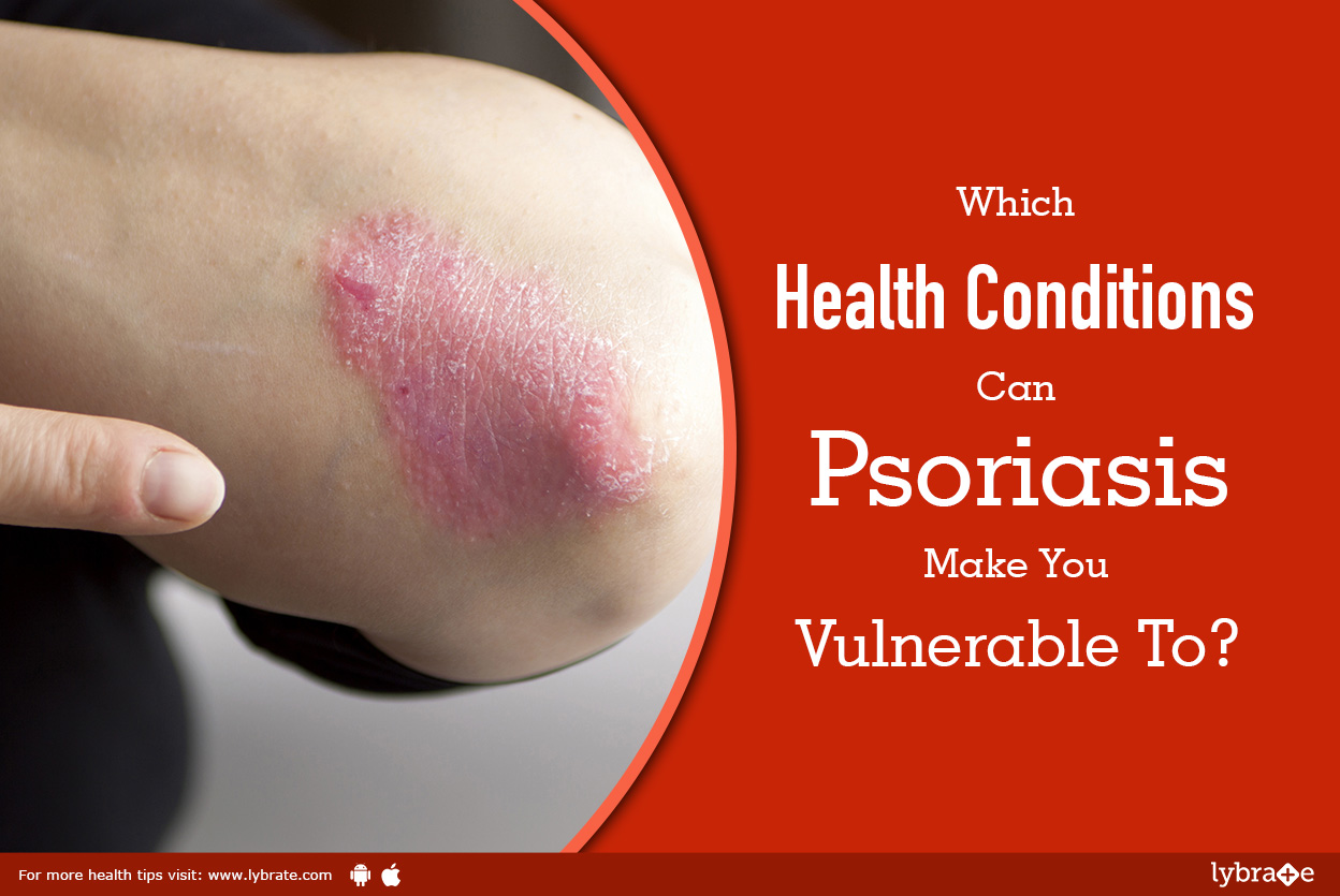 Which Health Conditions Can Psoriasis Make You Vulnerable To? - By Dr ...