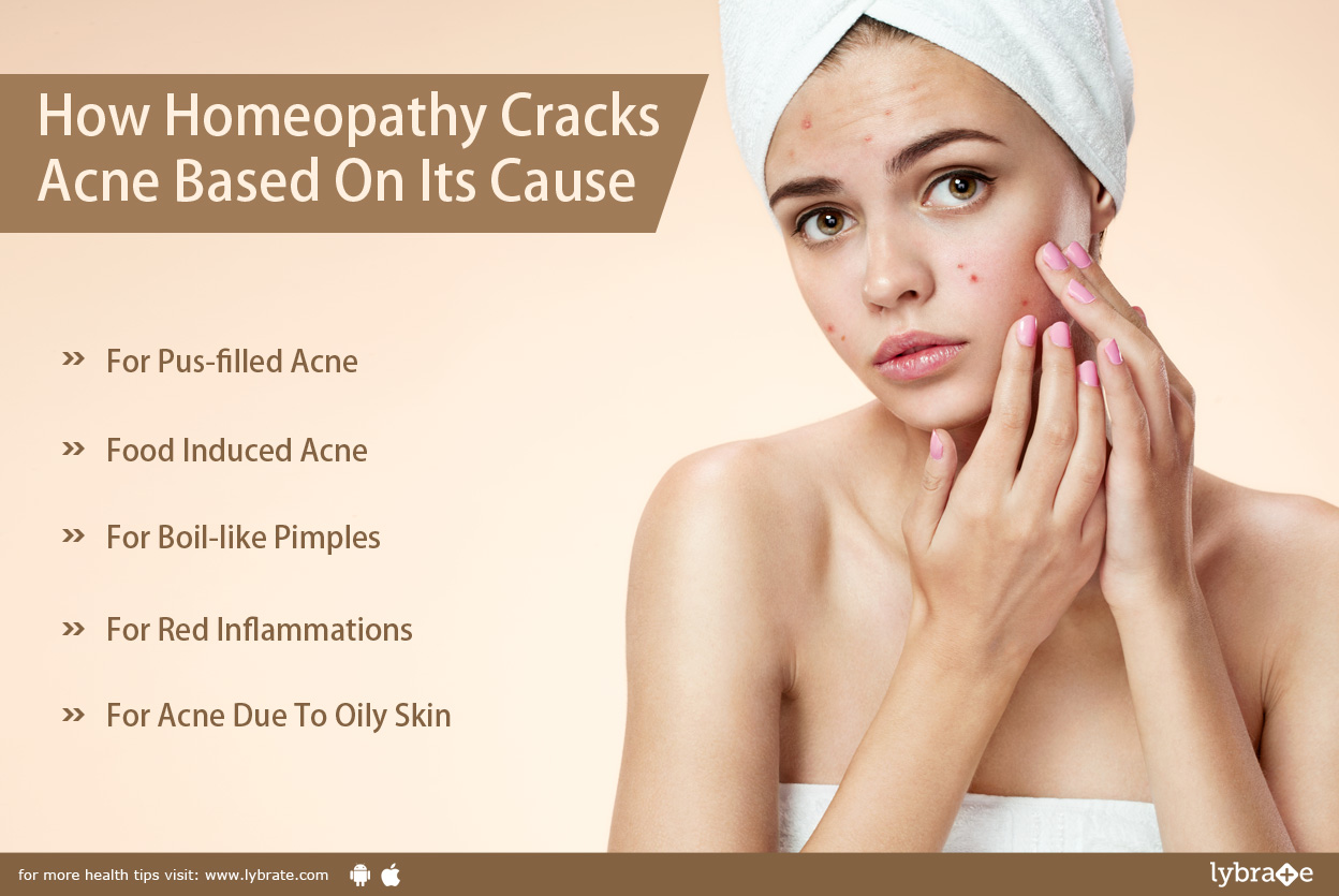 How Homeopathy Cracks Acne Based On Its Cause - By Dr. Bharti Bhutani ...
