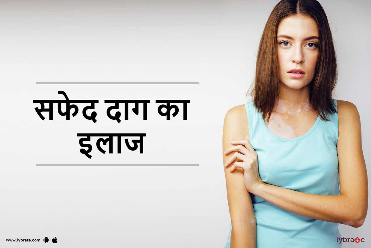 Safed Daag Ka ilaj - सफेद दाग का इलाज - By Dt. Radhika | Lybrate