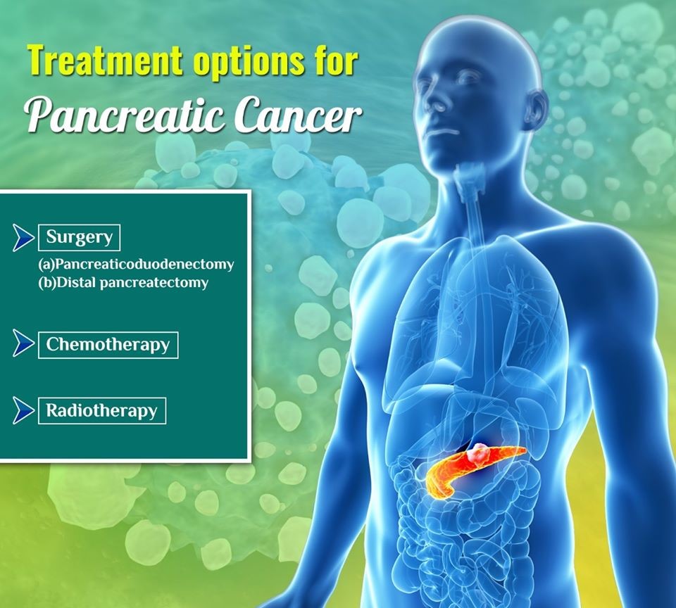 Treatment Options For Pancreatic Cancer! - By Dr. Nikhil Agrawal | Lybrate