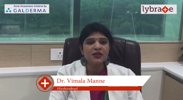 Lybrate | Dr. Vimala Manne speaks on IMPORTANCE OF TREATING ACNE EARLY ...
