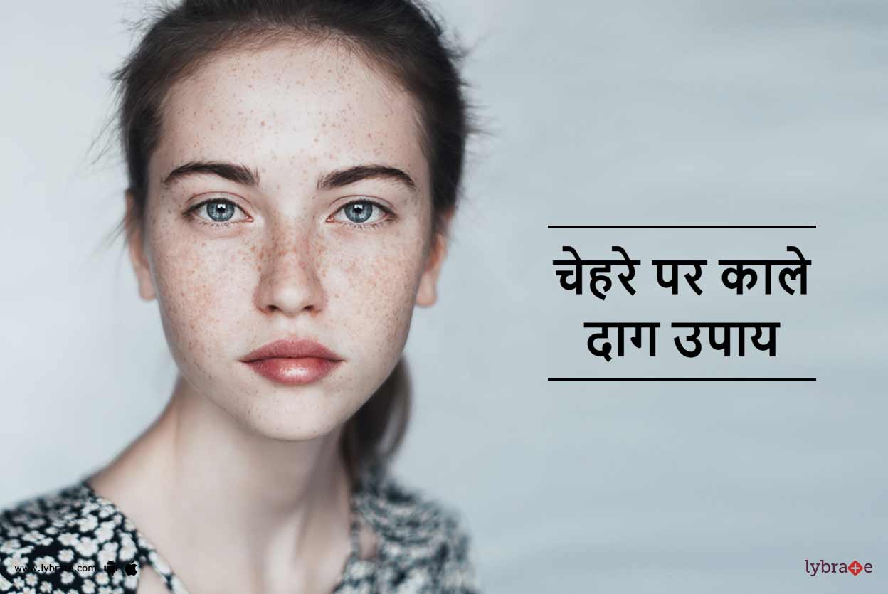 चेहरे पर काले दाग उपाय - Chehare Par Kaale Daag Ke Upaay! - By Dr ...