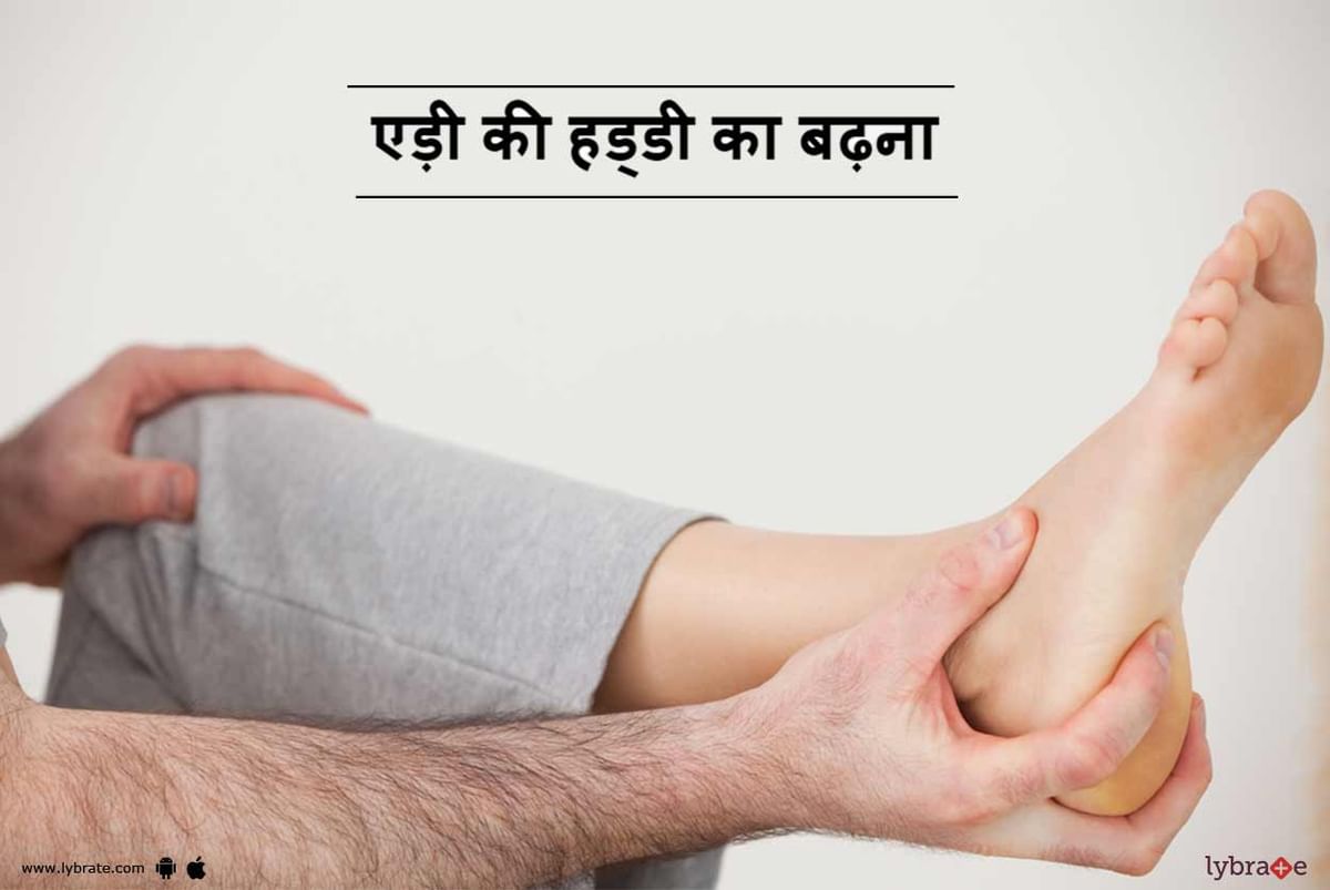 एड़ी की हड्डी का बढ़ना - Adi Ki Haddi Ka Badhna Ka Ilaj in Hindi एड़ी की हड्डी का बढ़ना - Adi Ki Haddi Ka Badhna Ka Ilaj in Hindi