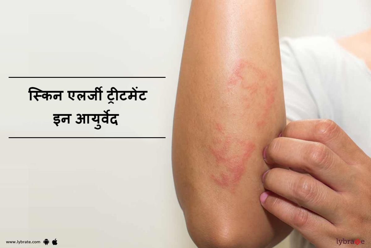 स्किन एलर्जी का आयुर्वेदिक इलाज़ और दवा Skin Allergy Treatment In
