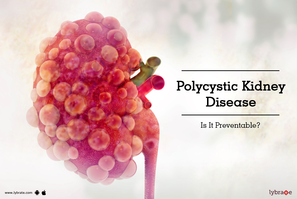 Polycystic Kidney Disease: Is it preventable? - By Dr. Garima | Lybrate