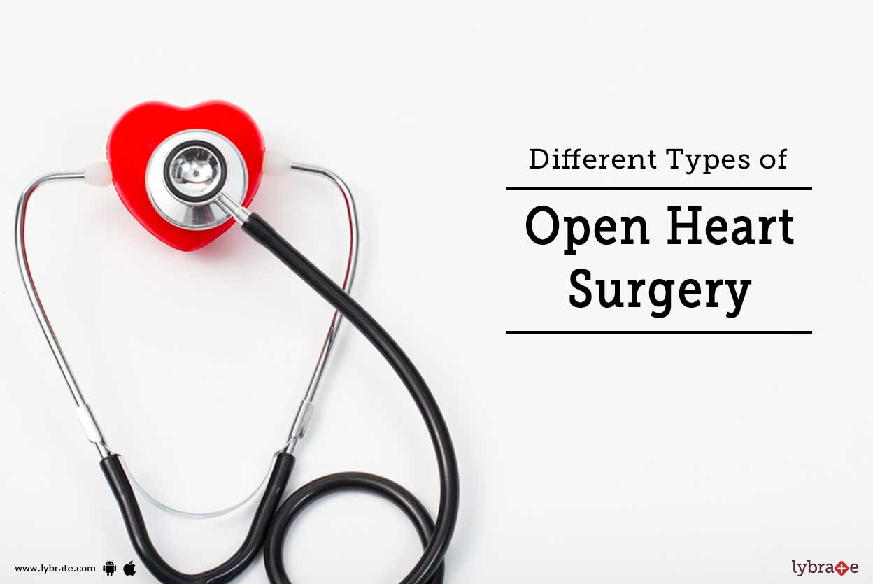 Different Types of Open Heart Surgery - By Dr. Garima | Lybrate