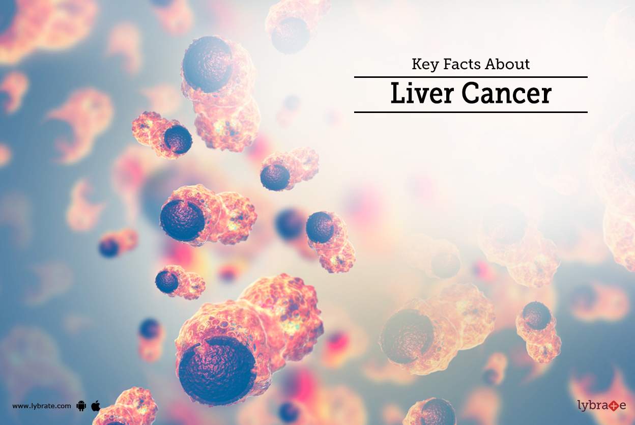 Key Facts About Liver Cancer - By Dr. Garima | Lybrate