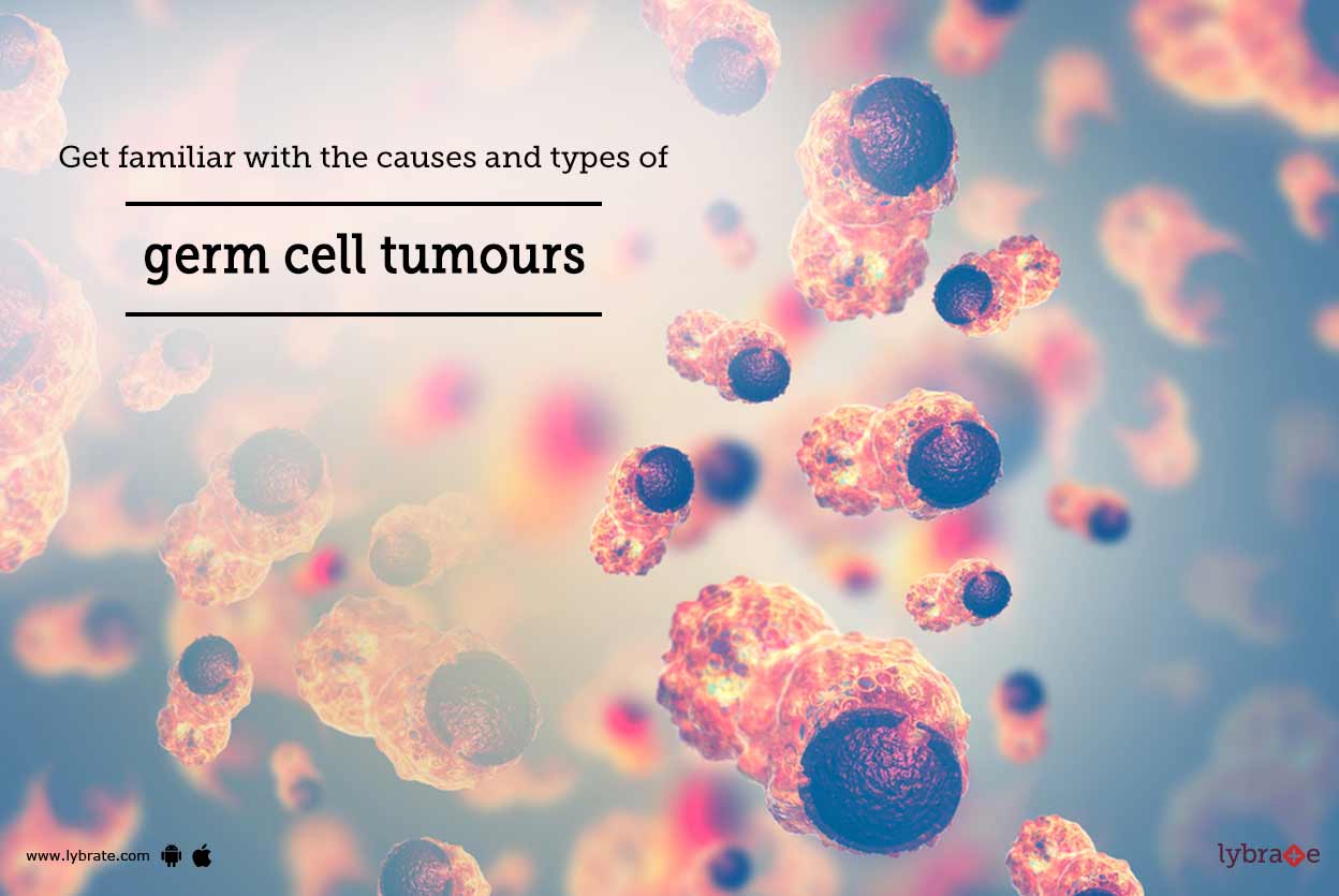 Get familiar with the causes and types of germ cell tumours - By Dr ...