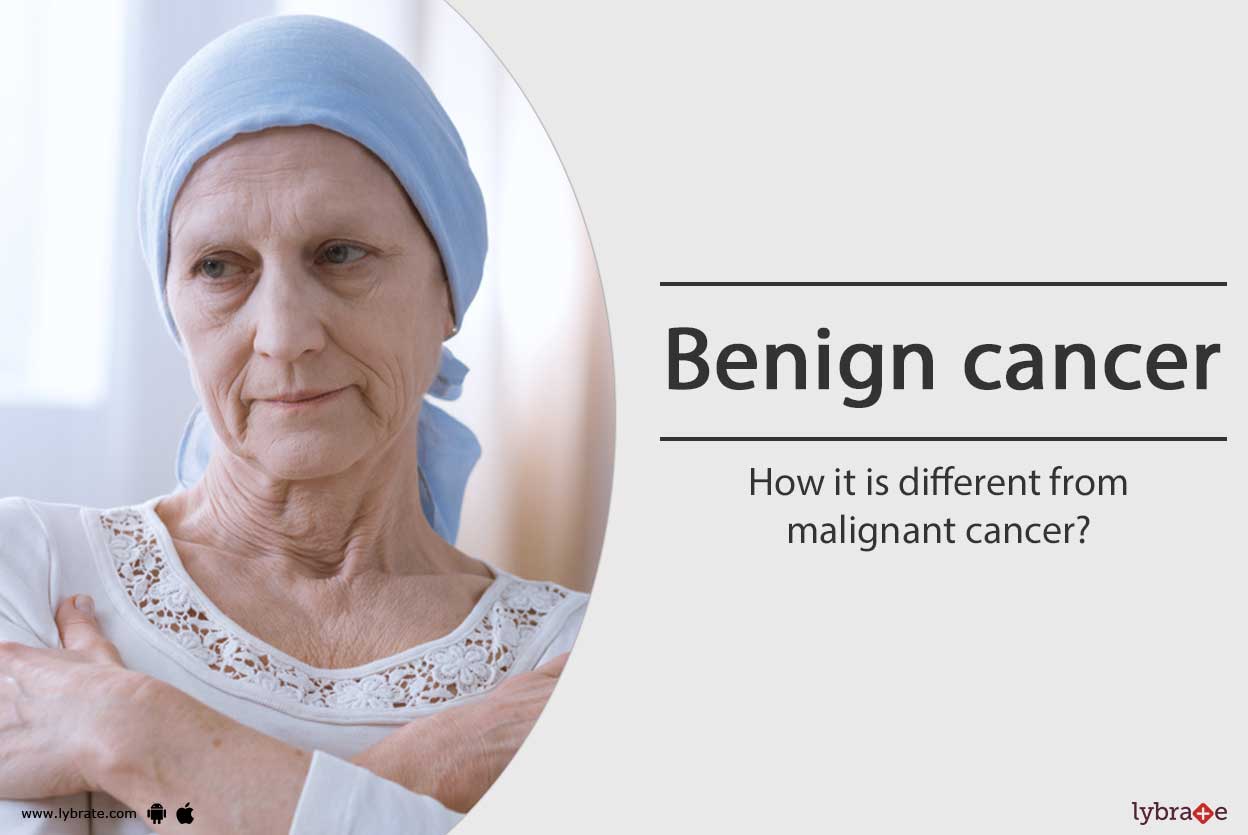 Benign Cancer: How is it different from malignant cancer? - By Dr ...