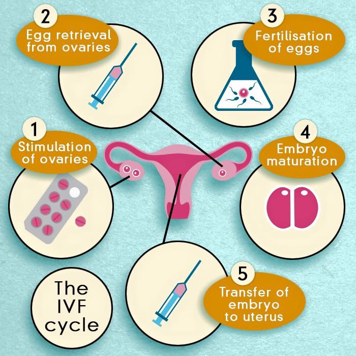What Is Test Tube Baby Process Or IVF By Dr Shikha Jain Lybrate