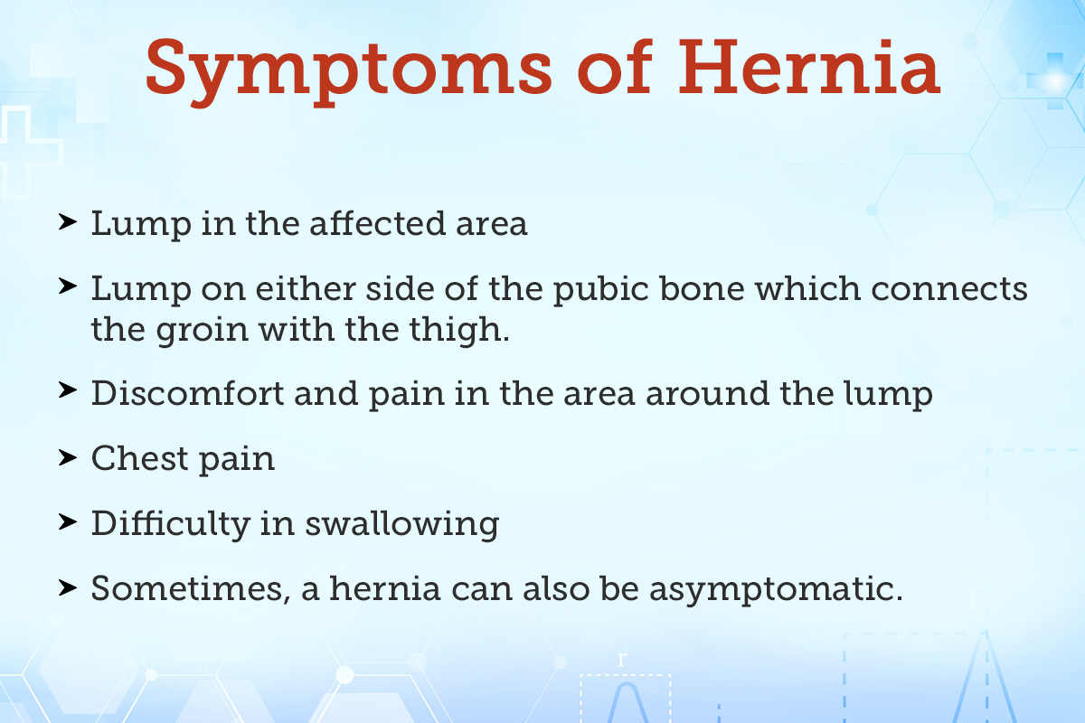 Top 999+ hernia images – Amazing Collection hernia images Full 4K