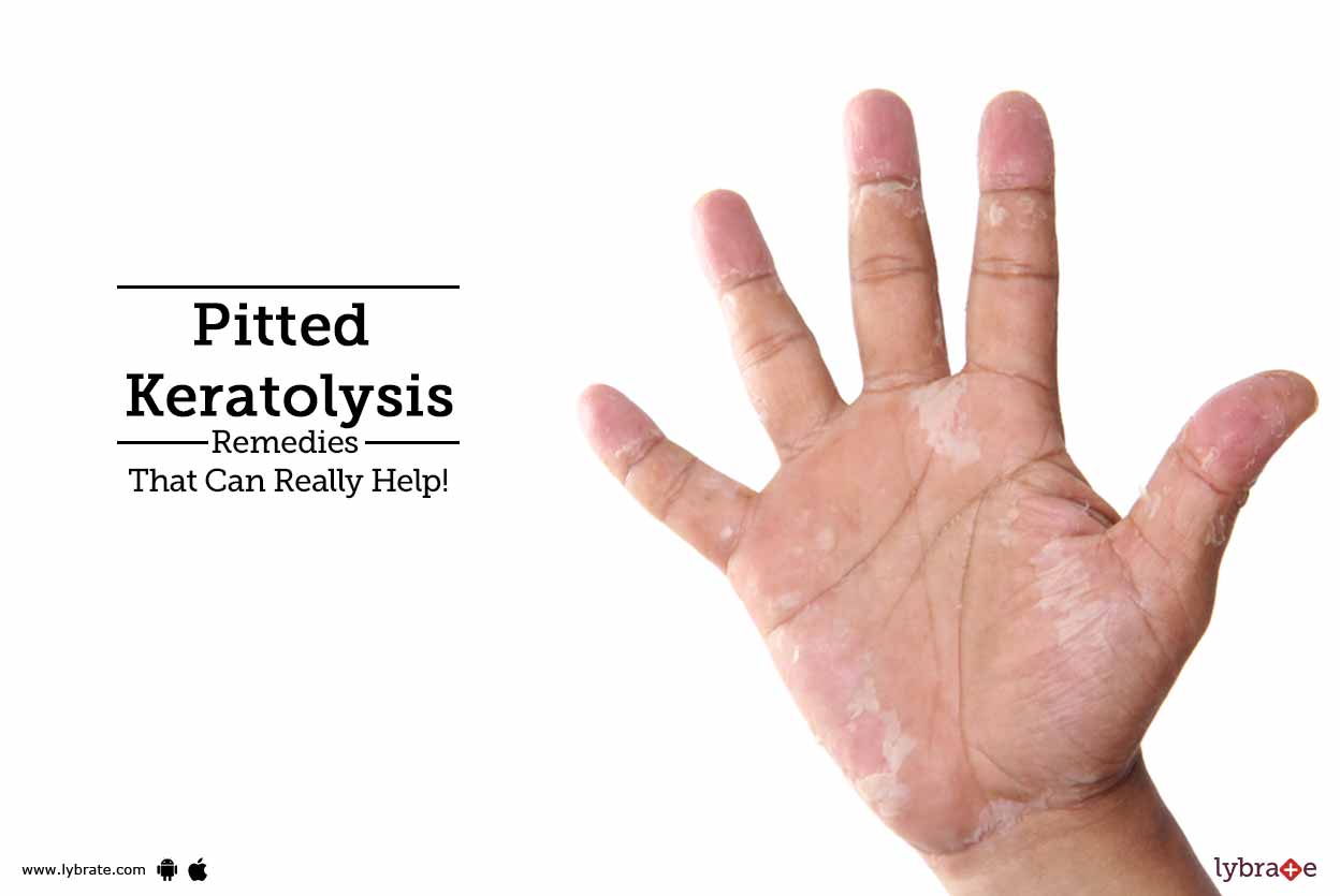 can pitted keratolysis go away by itself