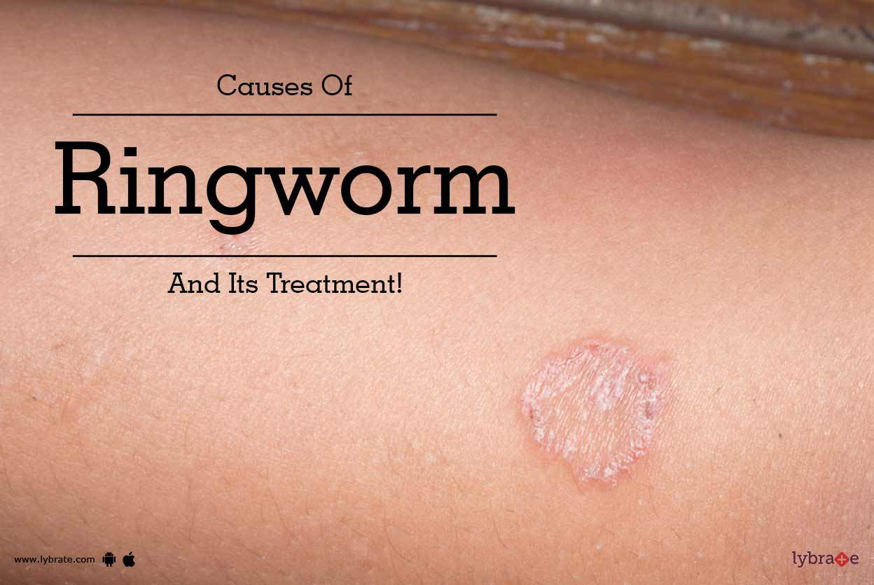 ringworm in adults causes