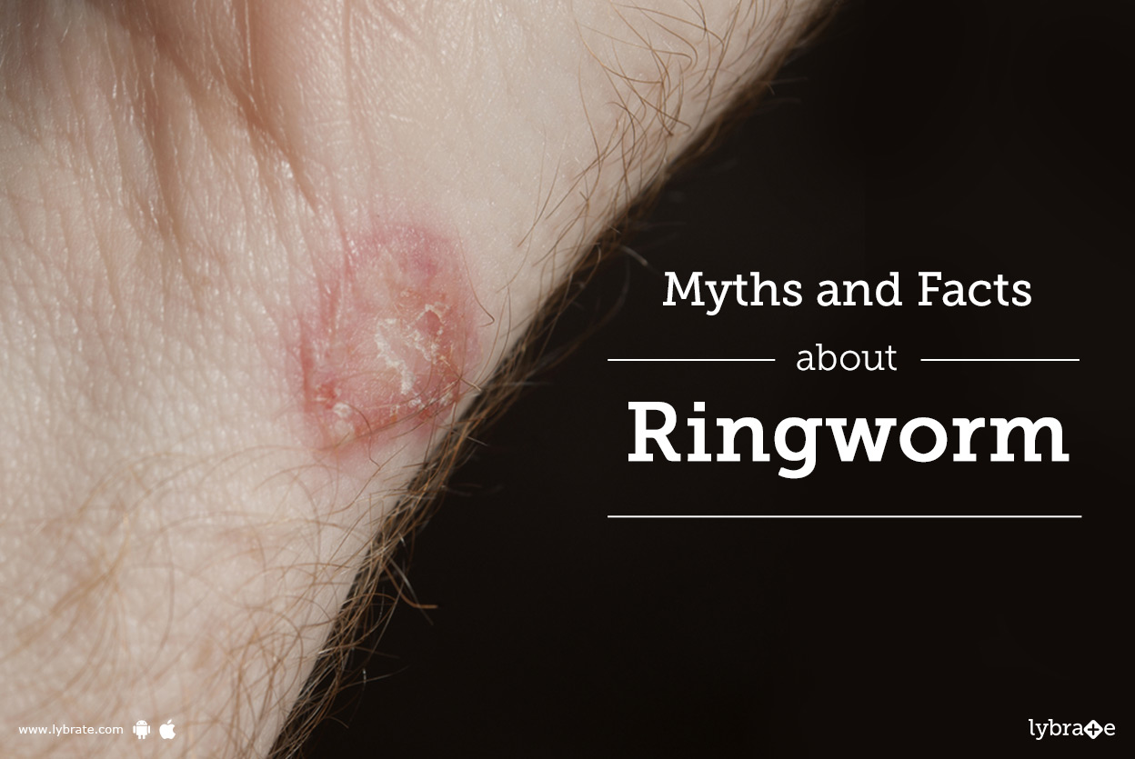 Ringworm In Pregnancy - PregnancyWalls