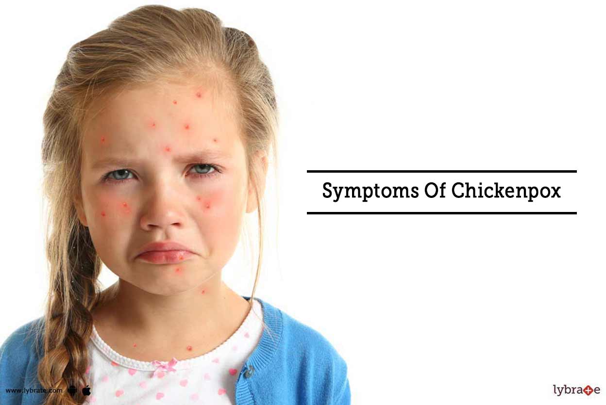 Symptoms Of Chickenpox: First Signs When You Might Be Having Chickenpox