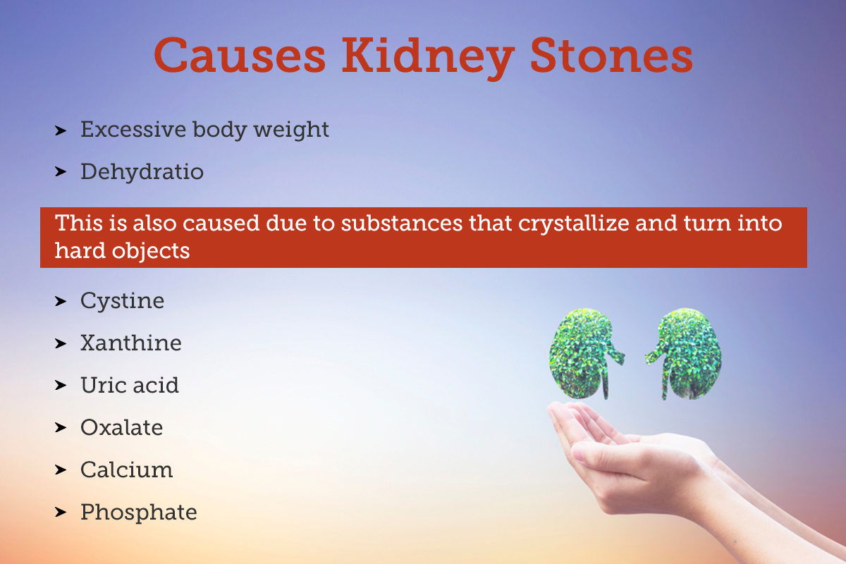 Kidney Stones: Causes, Symptoms, Treatments And More