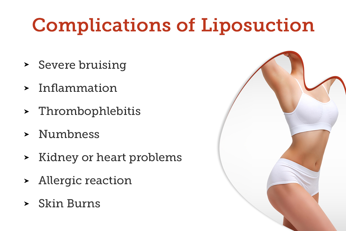 Liposuction - Types, Procedure, Diet, Cost And Side Effects