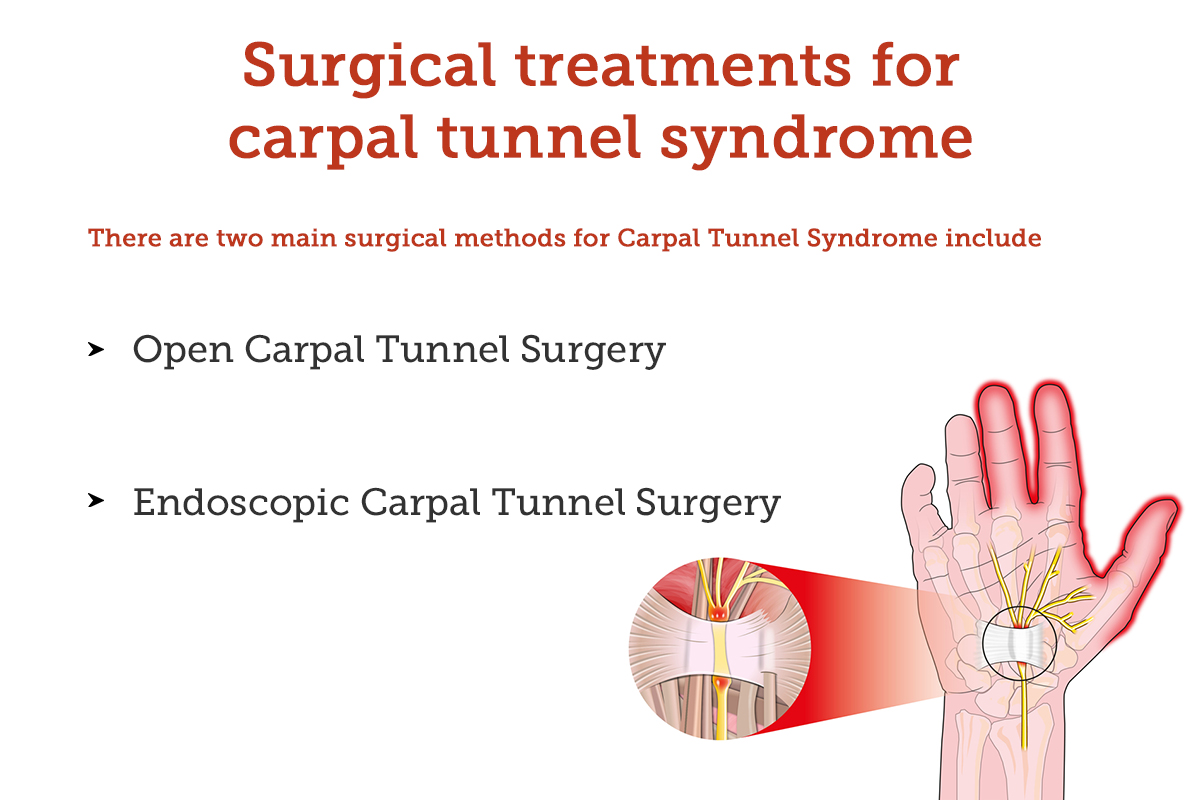 Carpal Tunnel Syndrome: Causes, Symptoms, Treatments And More