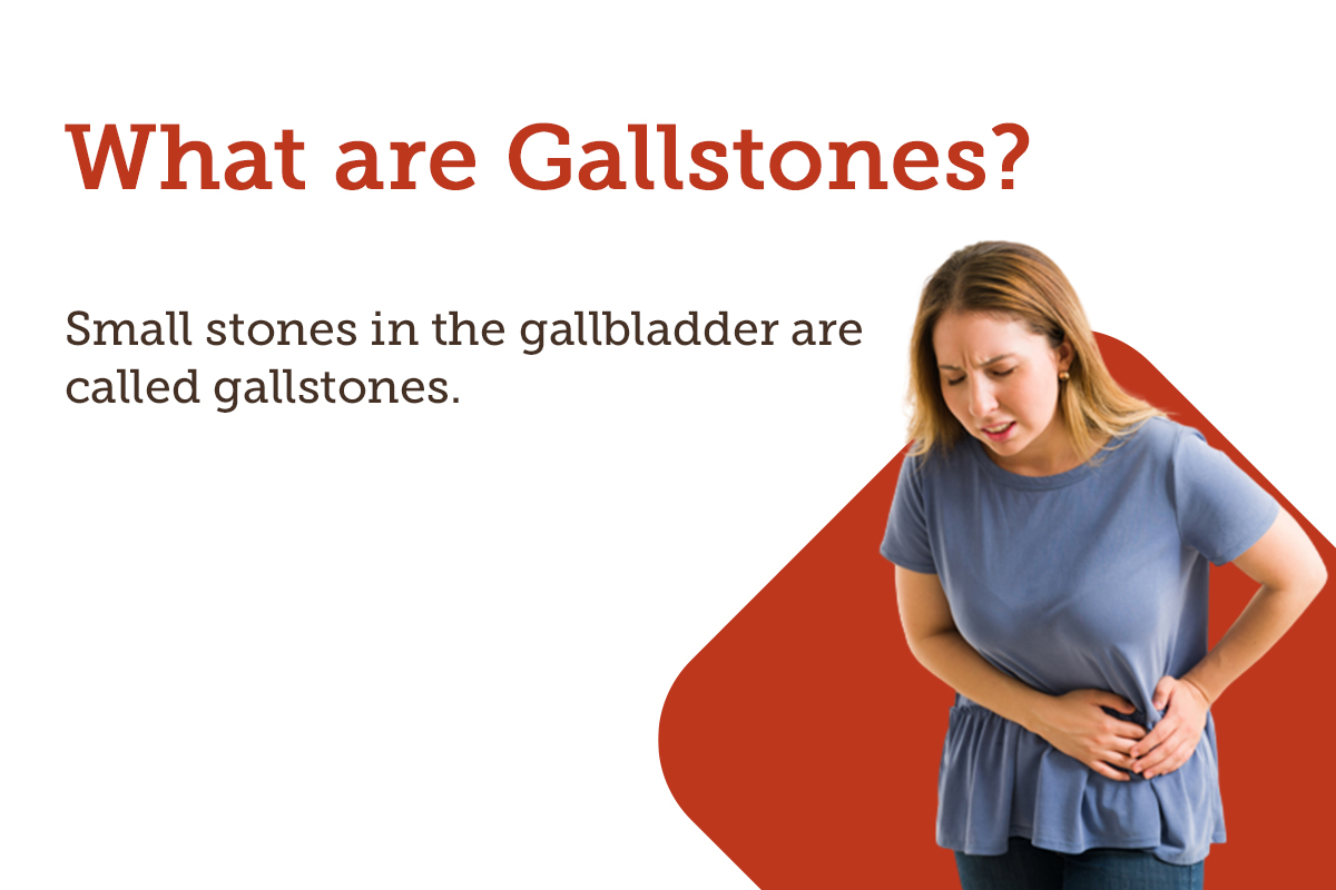 Gallstones: Treatment, Procedure, Cost, Recovery, Side Effects And More