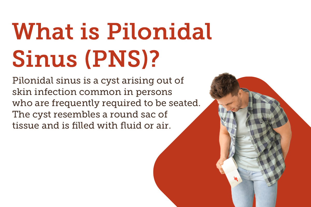 Pilonidal Sinus: Treatment, Procedure, Cost, Recovery, Side Effects And ...